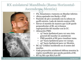 Posiciones de Craneo Unidad imagenologiaZ.pdf