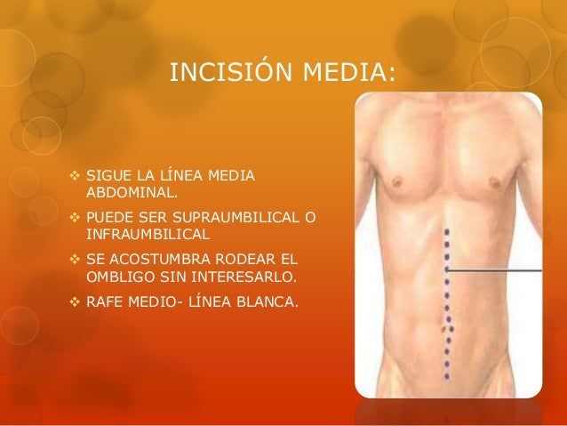 Posiciones e incisiones en cirugía