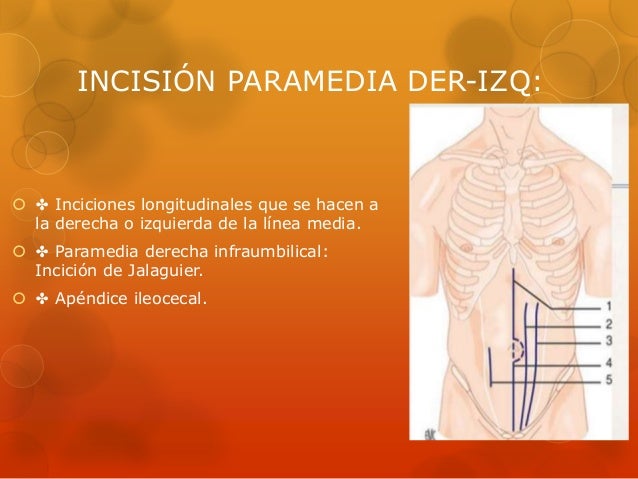 Posiciones e incisiones en cirugía