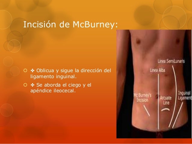 Posiciones e incisiones en cirugía