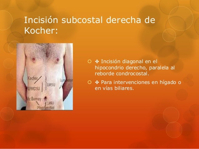 Posiciones e incisiones en cirugía