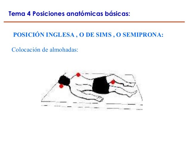 Posiciones quirurgicas