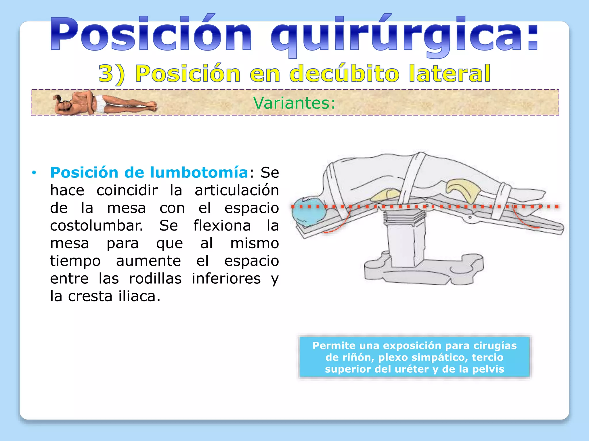 Posiciones quirurgicas mas frecuentes
