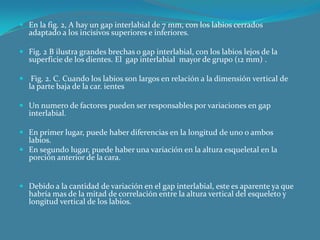 Posicion labial y su significado en el plan de tratamiento | PPTX