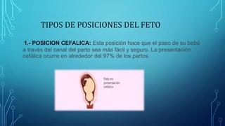 POSICION Y SITUACION DEL FETO DE LA CARRERA DE ENFERMERIA.pptx