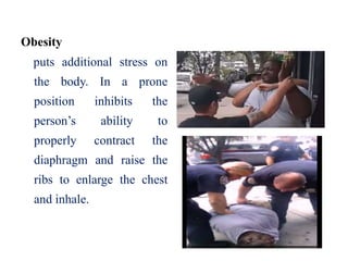 Positional asphyxia | PPTX