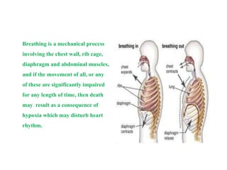 Positional asphyxia | PPT