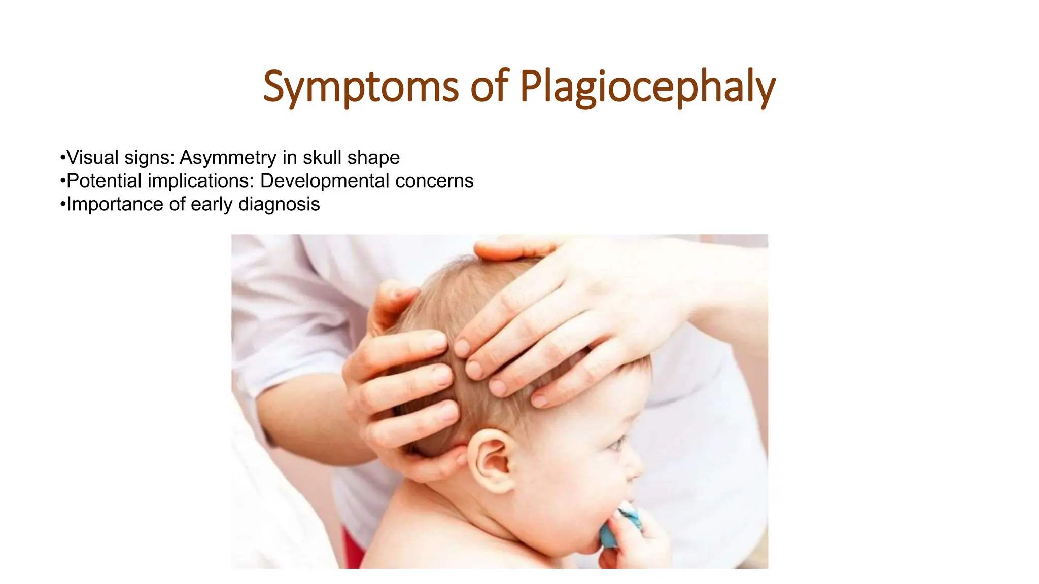 Effective Treatment Solutions for Positional Plagiocephaly | PPT