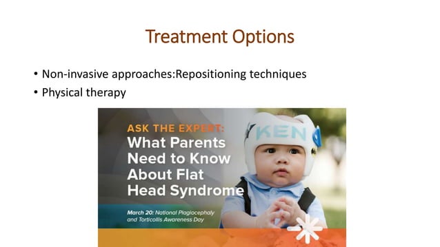 Effective Treatment Solutions for Positional Plagiocephaly | PPT