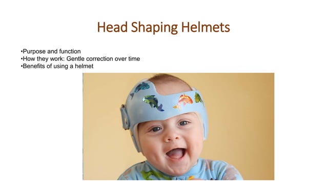 Effective Treatment Solutions for Positional Plagiocephaly | PPT