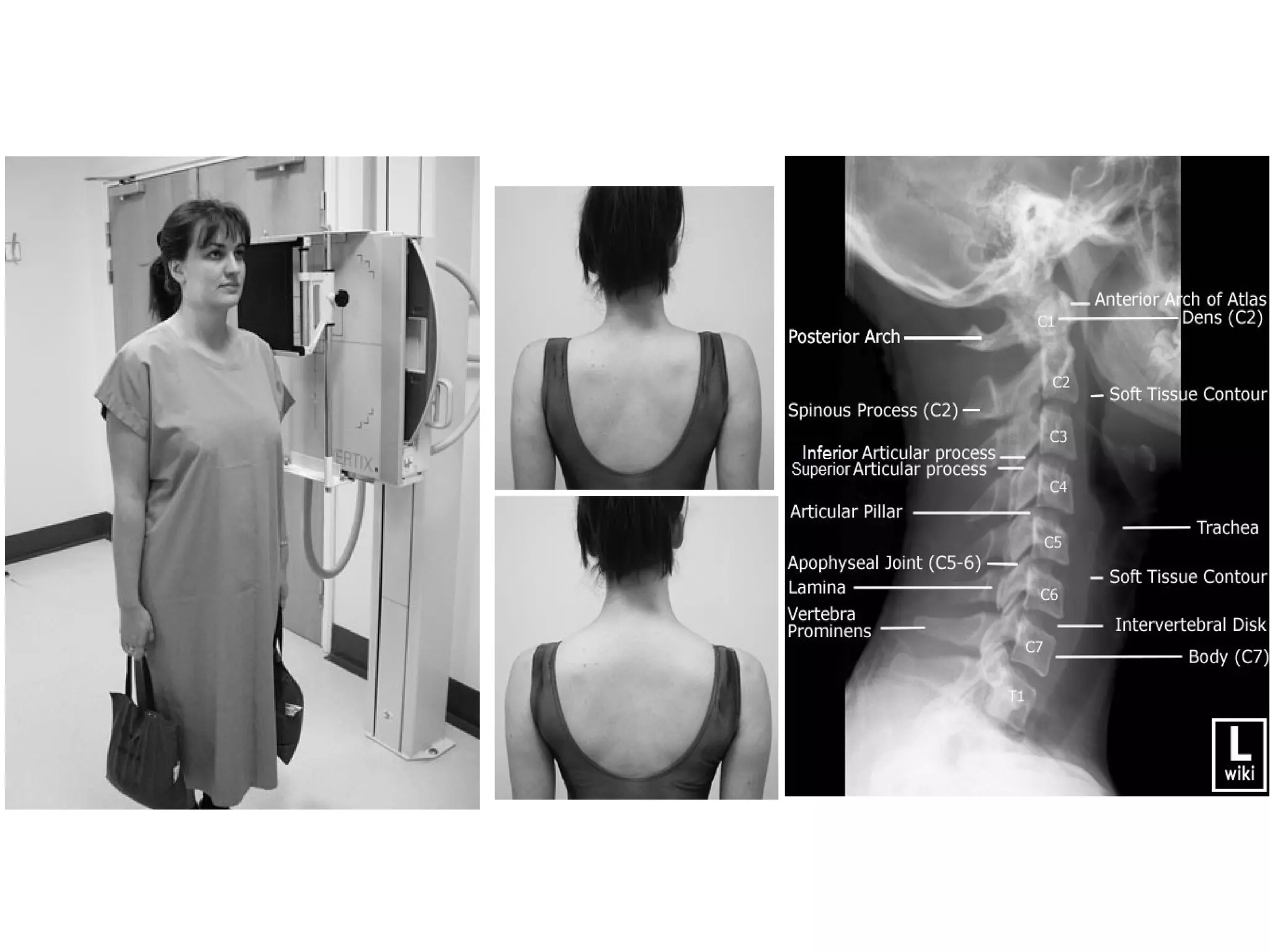 Radiography Positioning Spine | PPT
