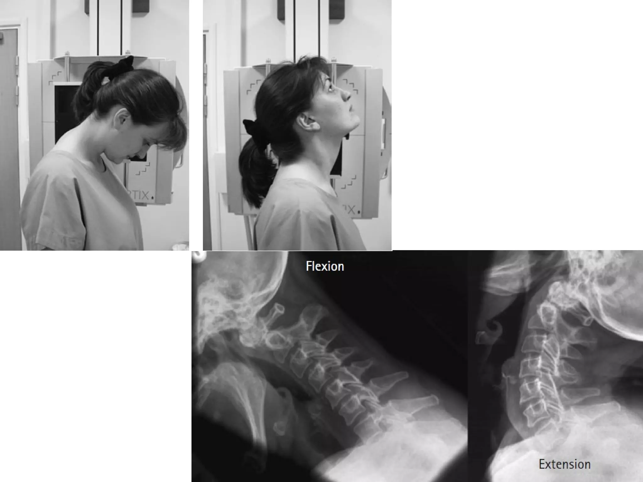 Radiography Positioning Spine | PPT