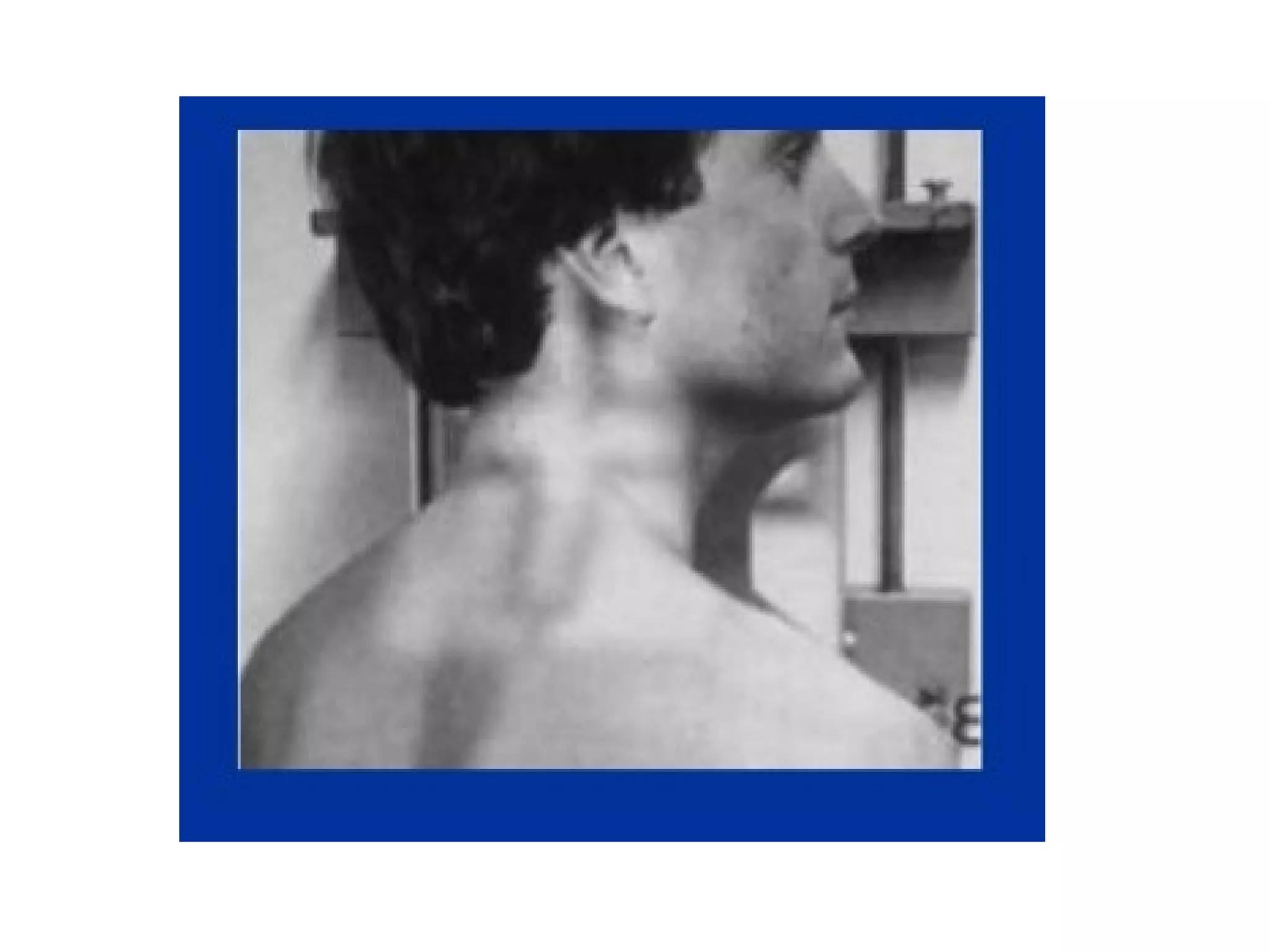 Radiography Positioning Spine | PPT