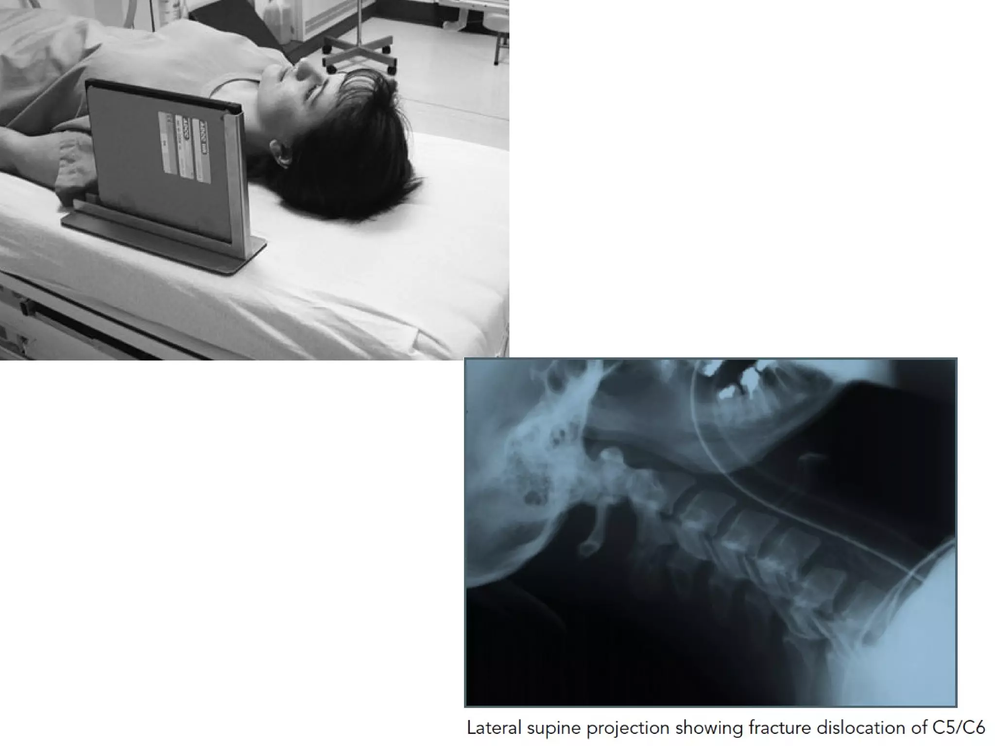 Radiography Positioning Spine | PPT