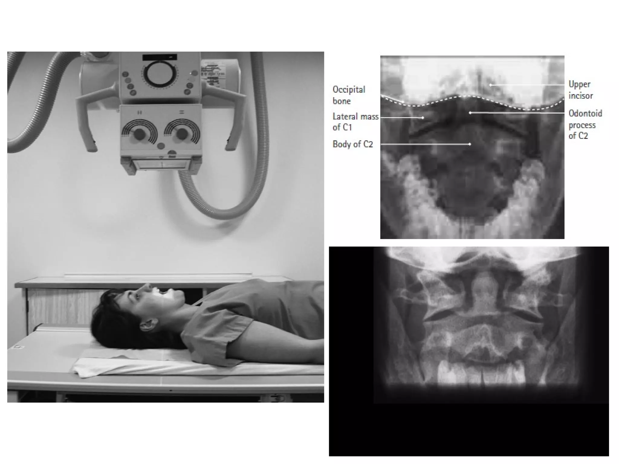 Radiography Positioning Spine | PPT