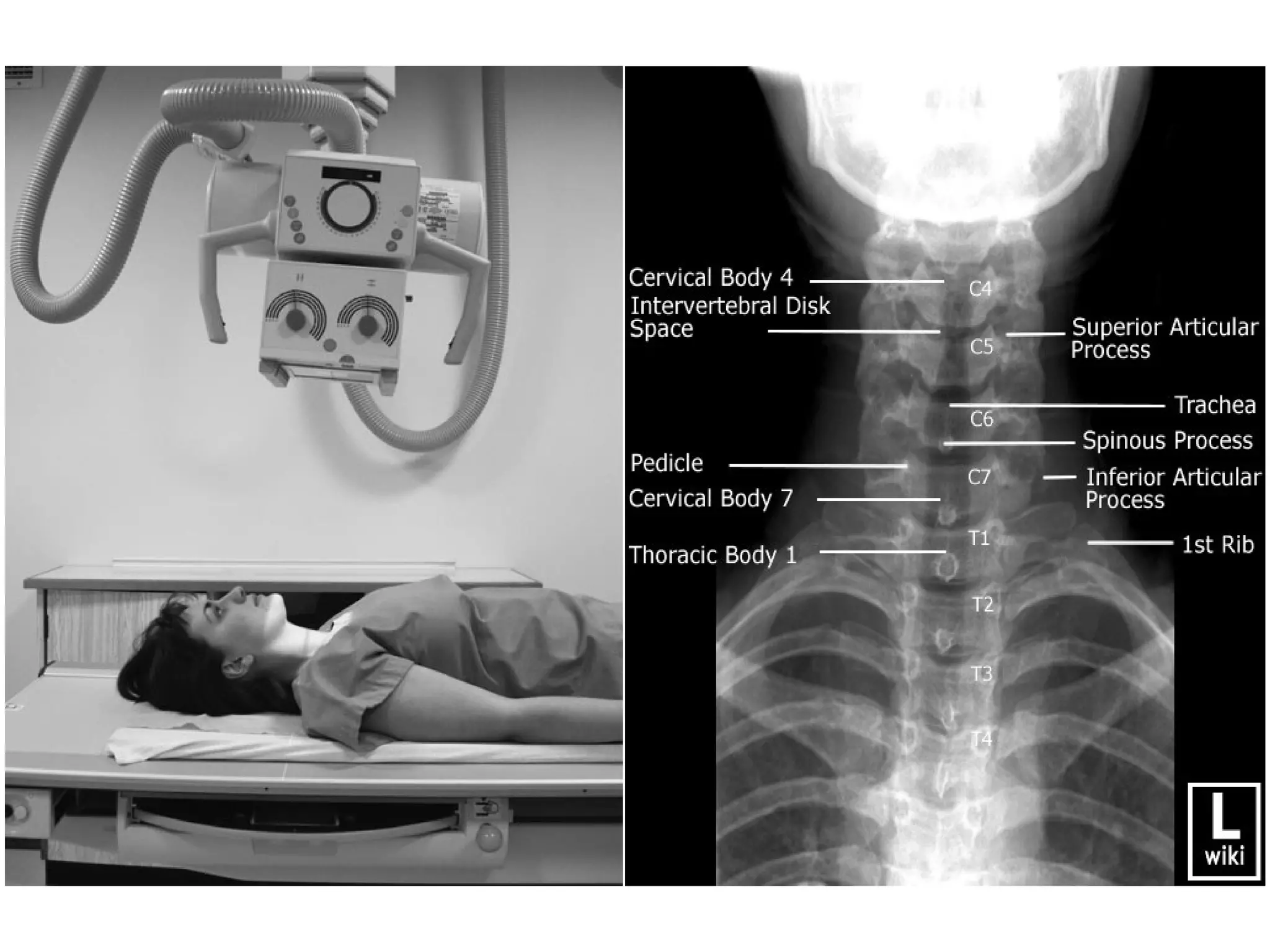 Radiography Positioning Spine | PPT