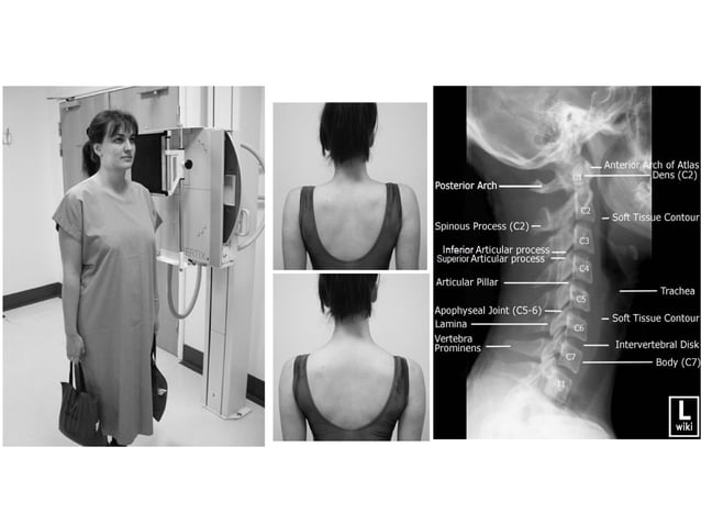 Radiography Positioning Spine | PPT