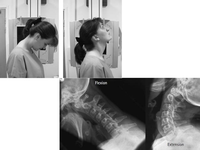 Radiography Positioning Spine | PPT