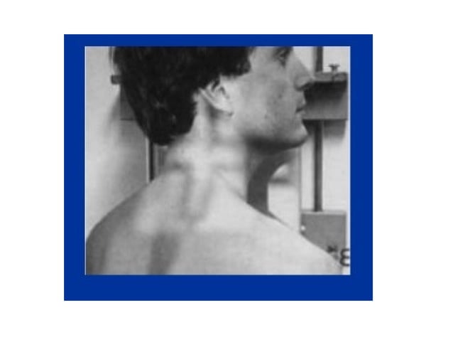 Radiography Positioning Spine | PPT