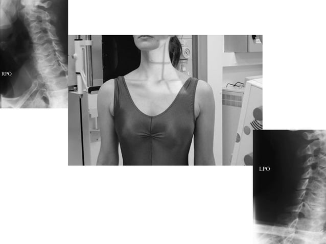 Radiography Positioning Spine | PPT