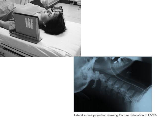 Radiography Positioning Spine | PPT
