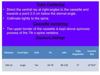 Radiography Positioning Spine | PPT