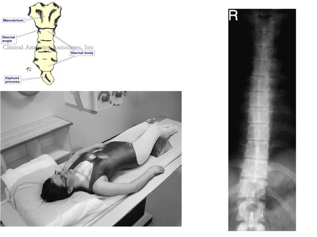 Radiography Positioning Spine | PPT