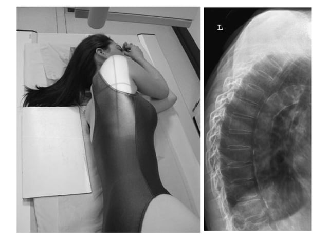 Radiography Positioning Spine | PPT