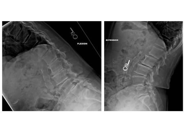 Radiography Positioning Spine | PPT