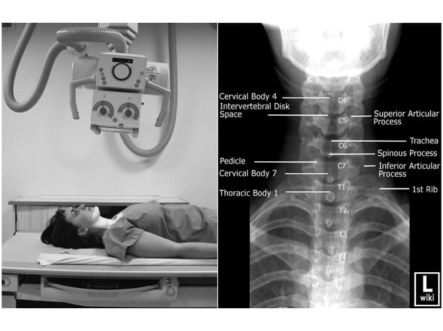 Radiography Positioning Spine | PPT