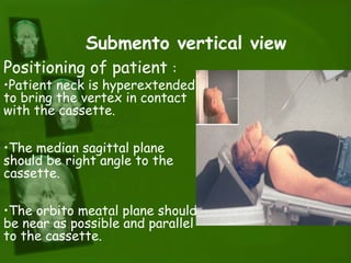 all about x-ray positioning positioning.ppt