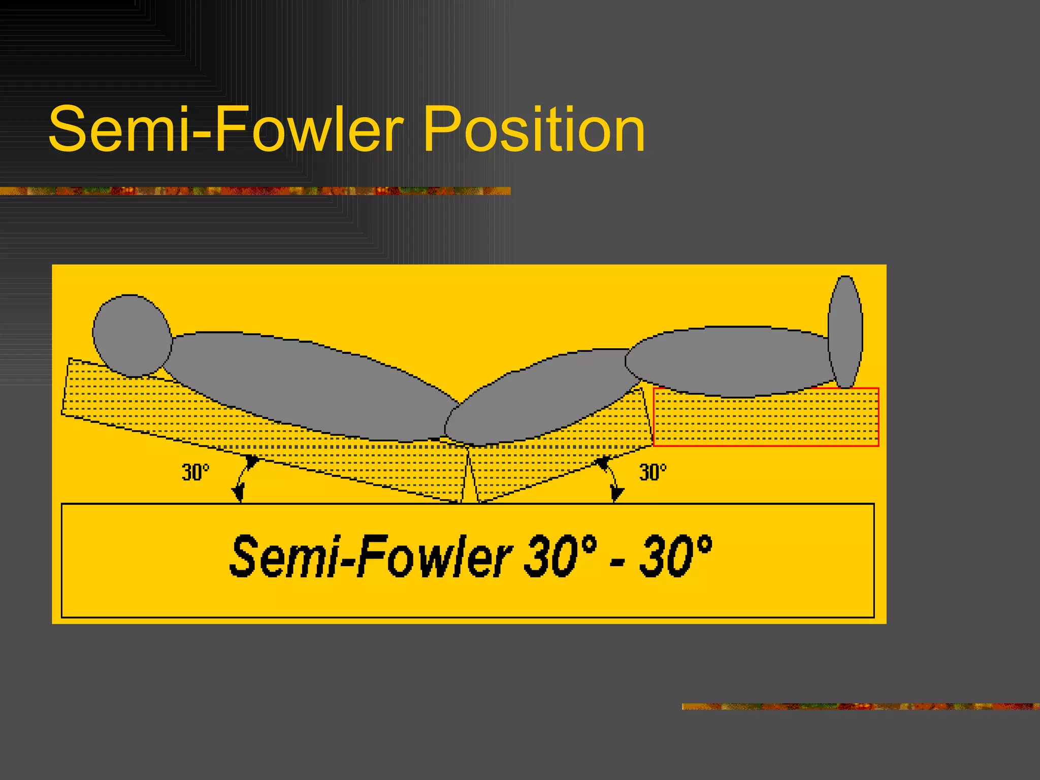 Positioning And Draping And Bed Mobility Power Point | PPT