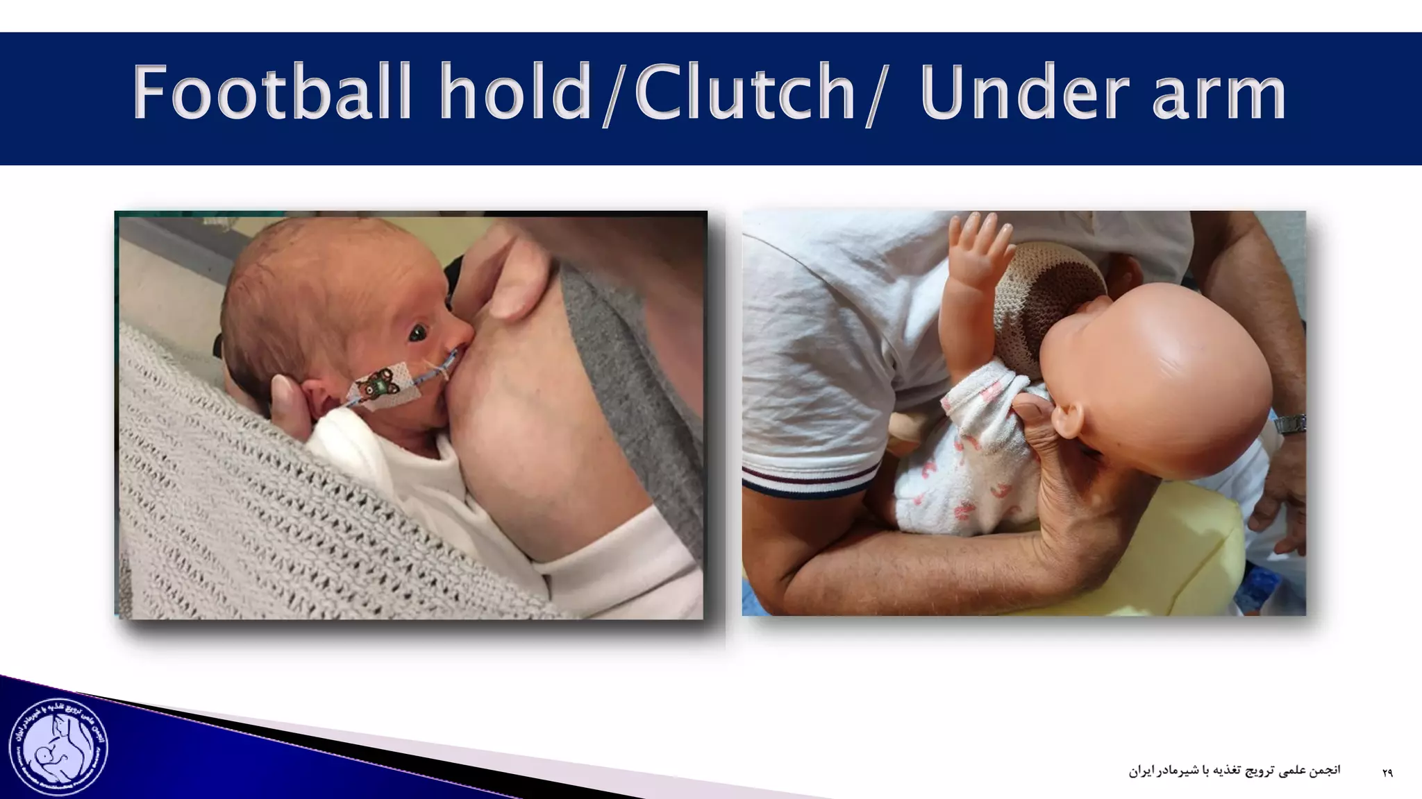 Positioning and latch on in preterm infants dr ravari | PDF