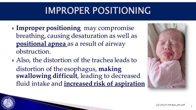 Positioning and latch on in preterm infants dr ravari | PPT