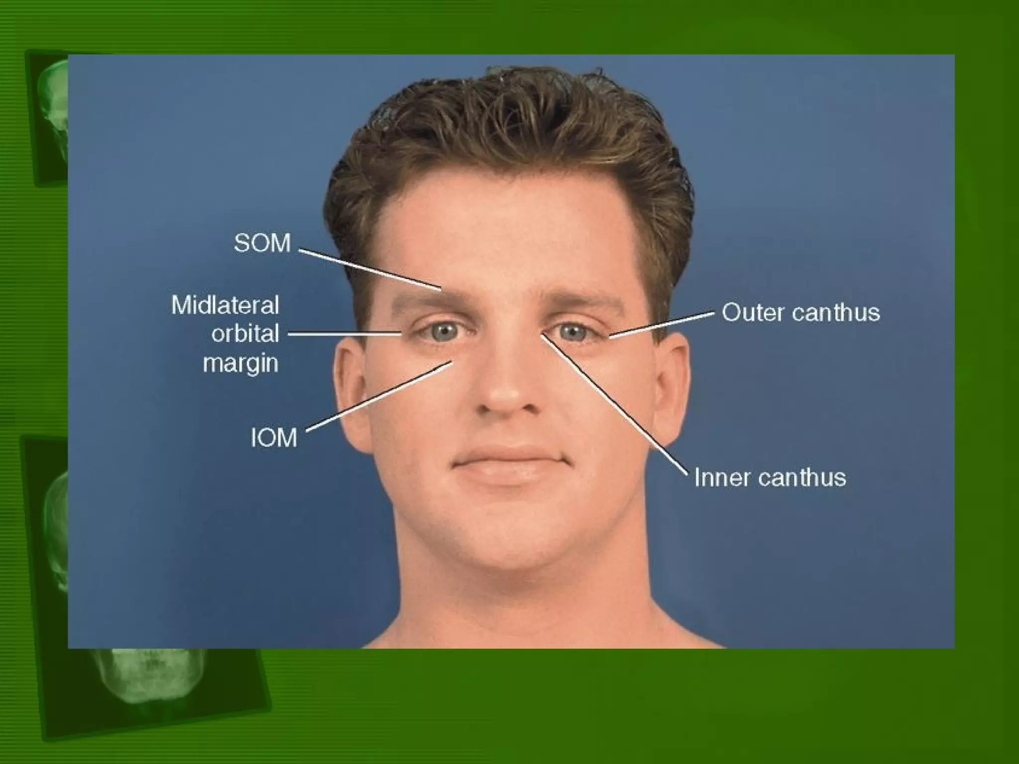 Positioning and radiographic anatomy of the skull | PPT