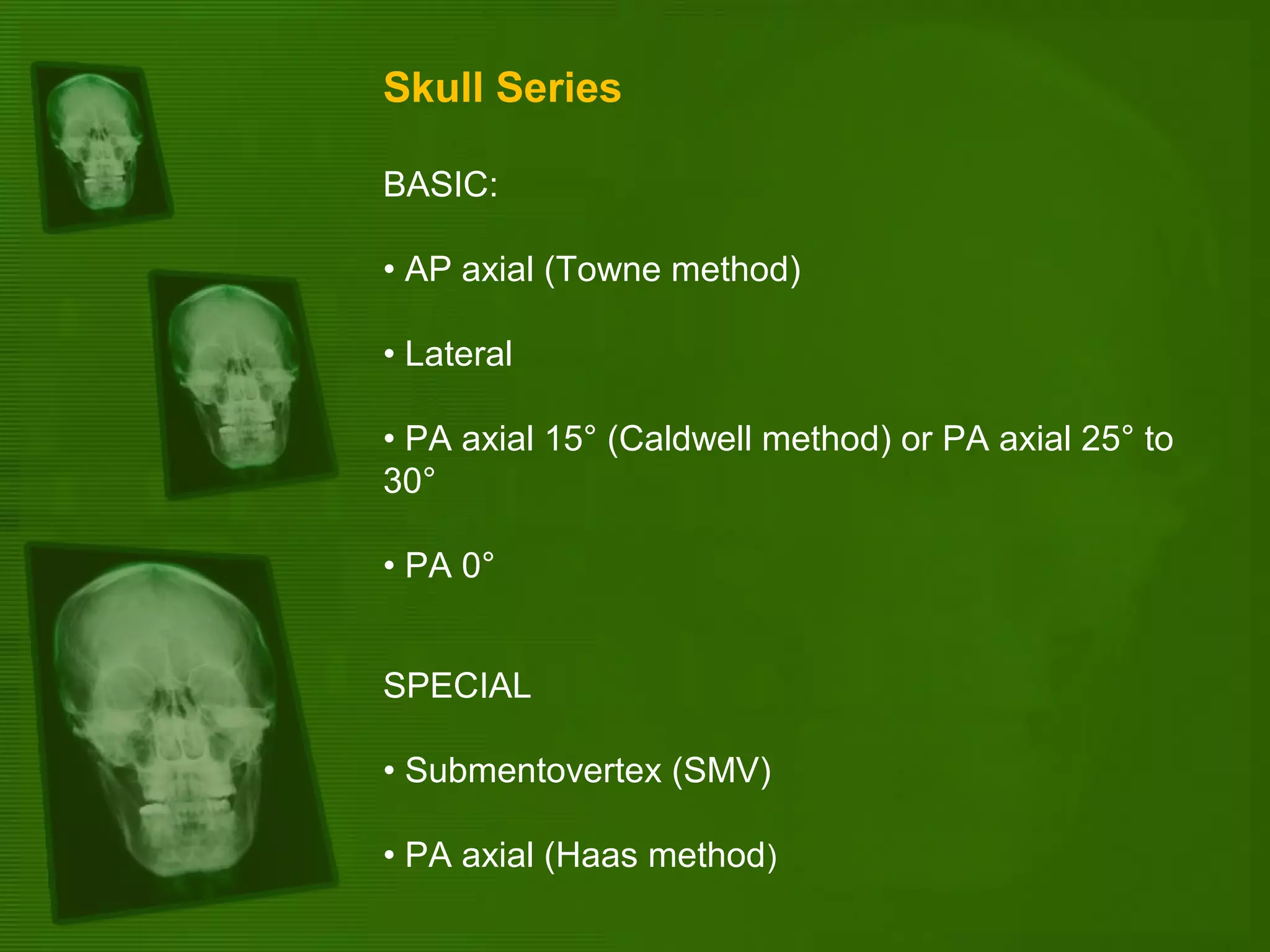 Positioning and radiographic anatomy of the skull | PPT | Bone and ...