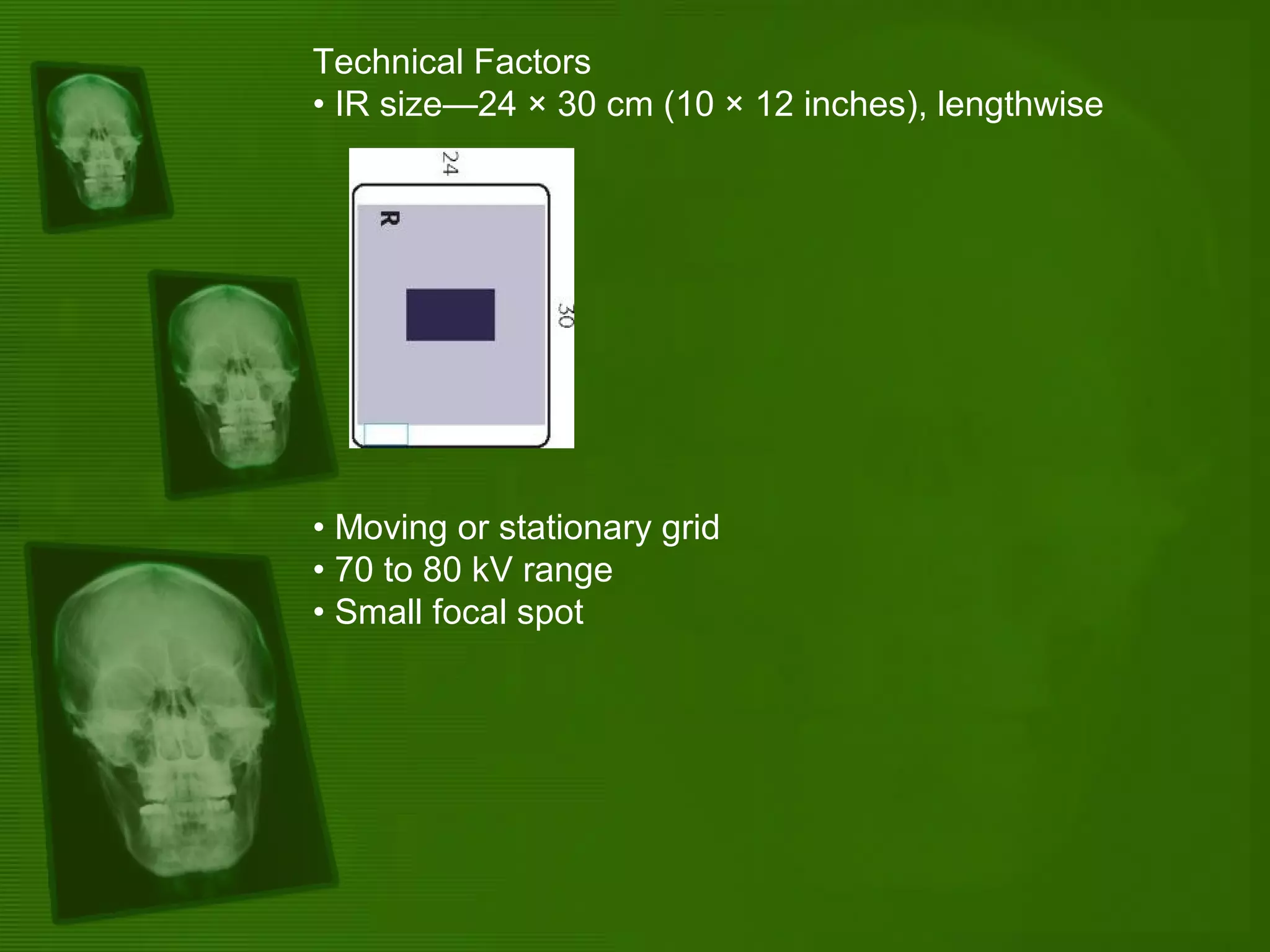 Positioning and radiographic anatomy of the skull | PPT | Bone and ...
