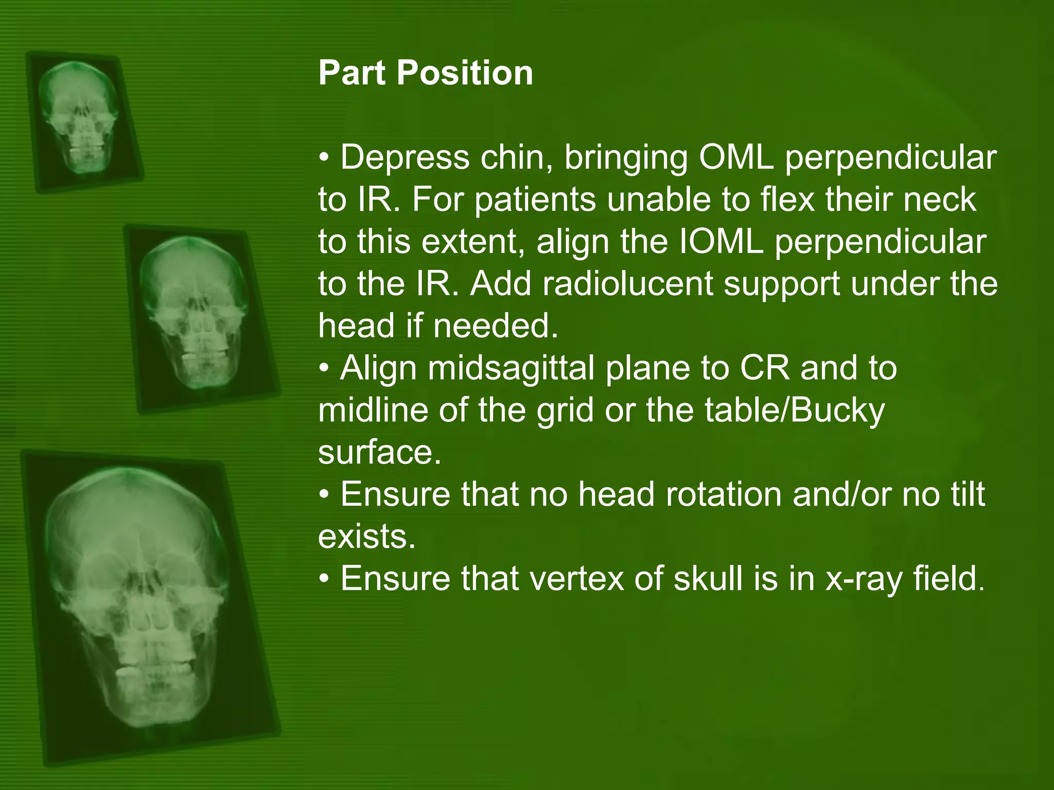 Positioning and radiographic anatomy of the skull | PPT