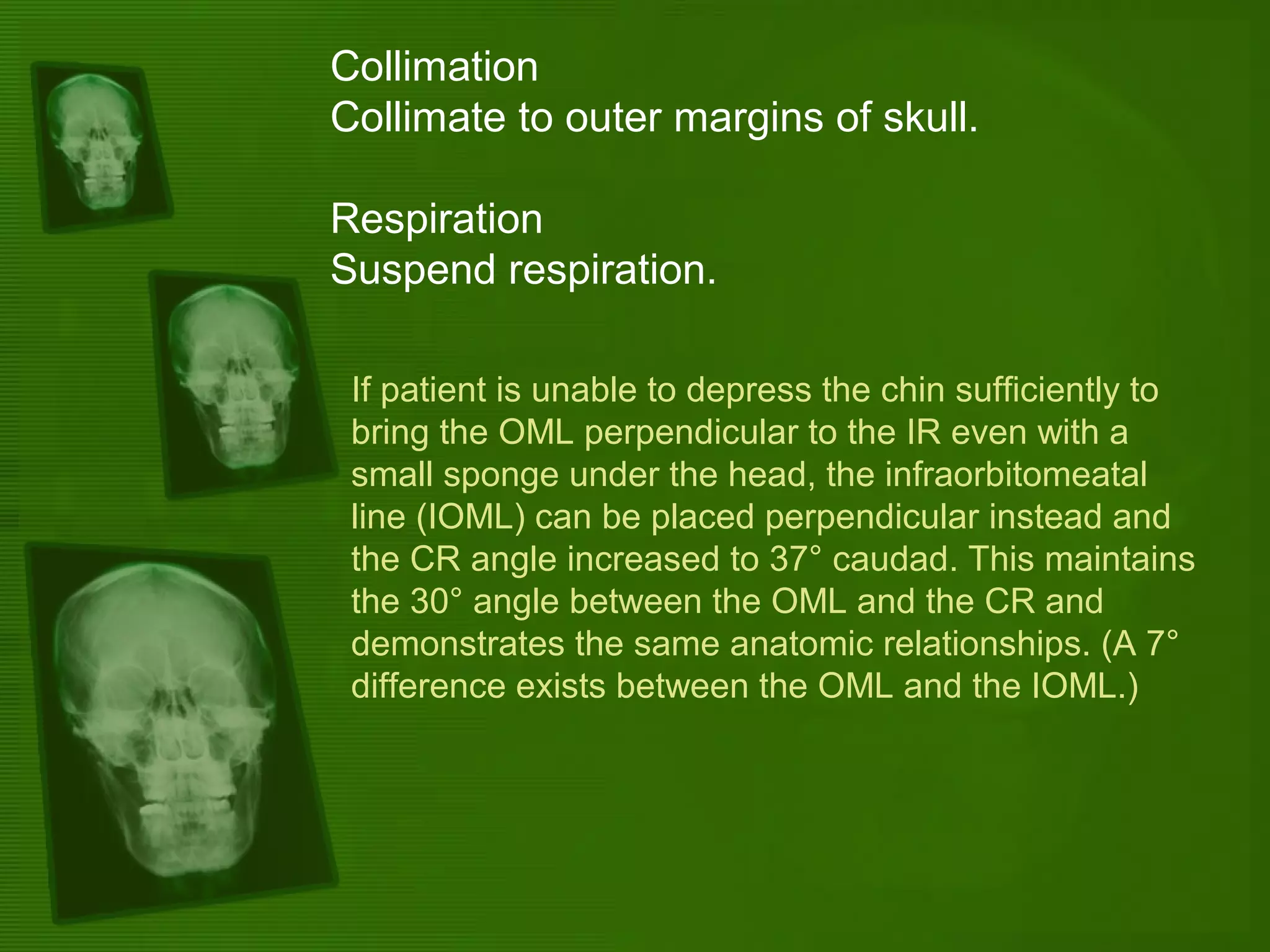 Positioning and radiographic anatomy of the skull | PPT