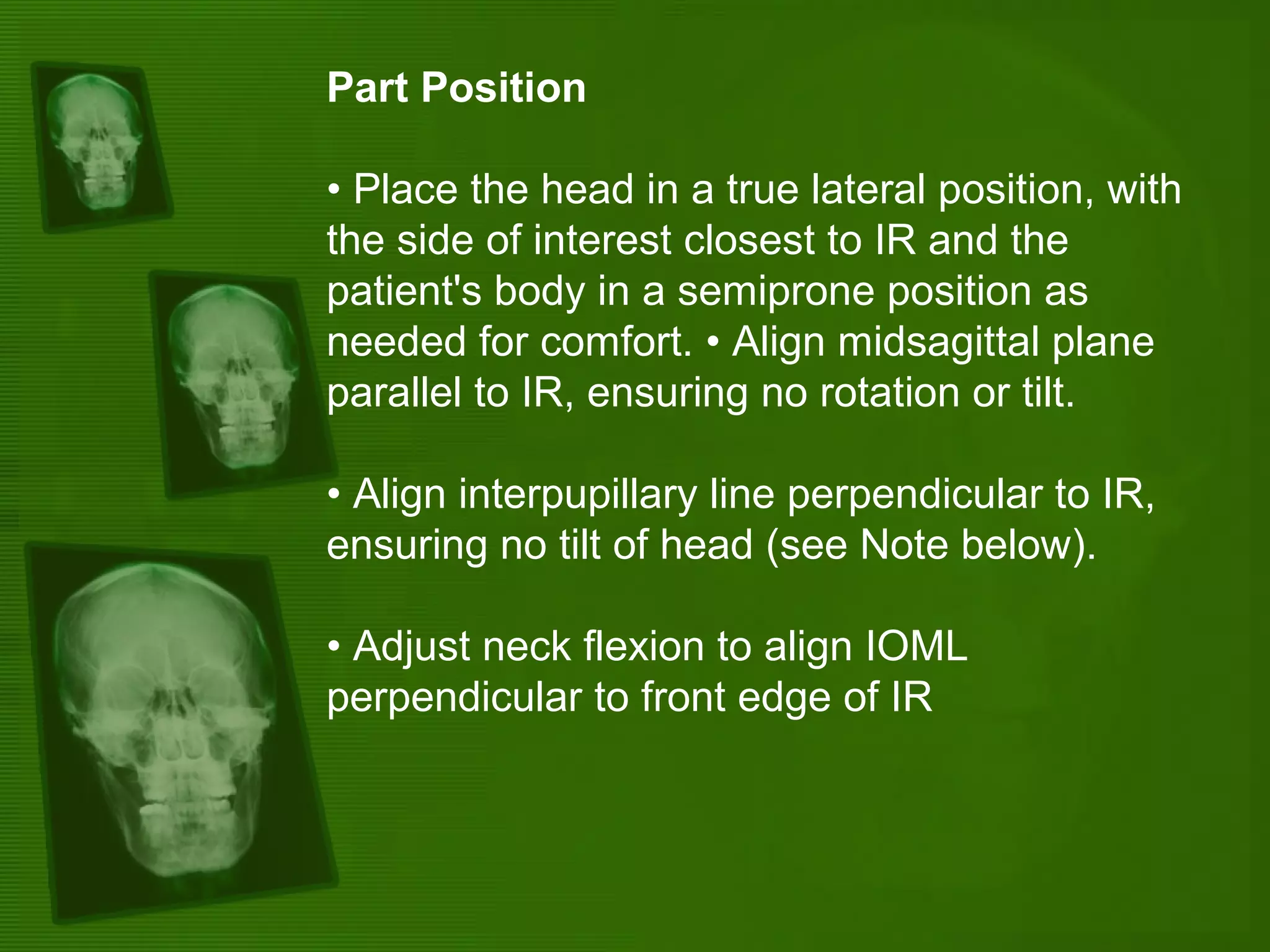 Positioning and radiographic anatomy of the skull | PPT
