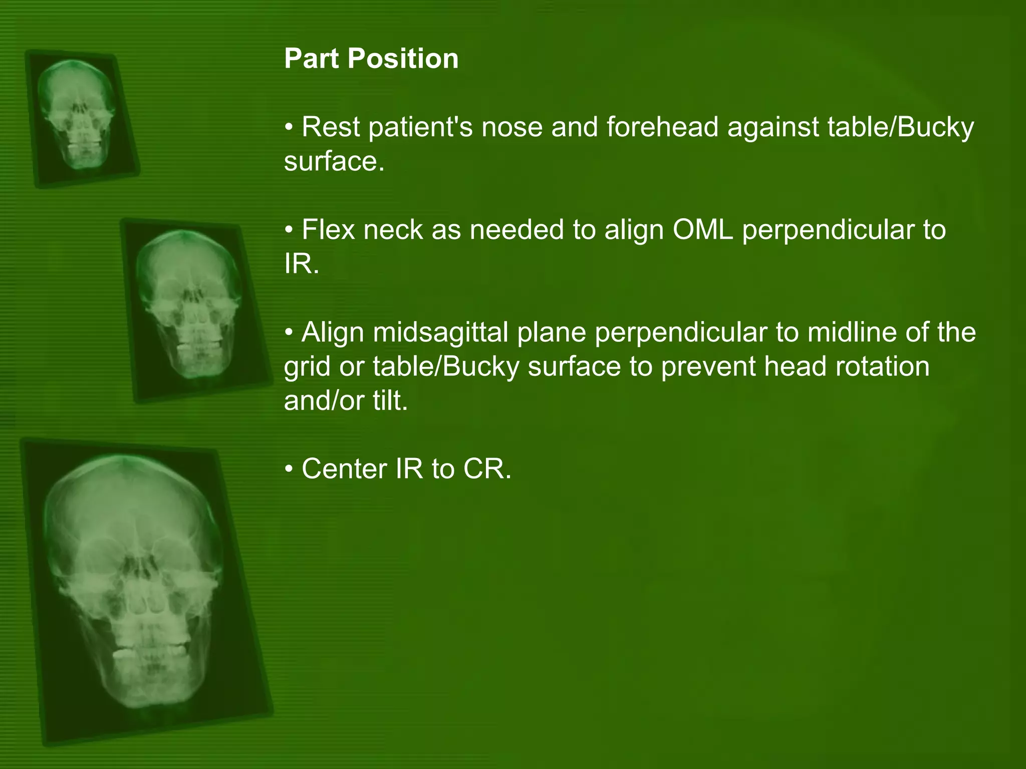 Positioning and radiographic anatomy of the skull | PPT