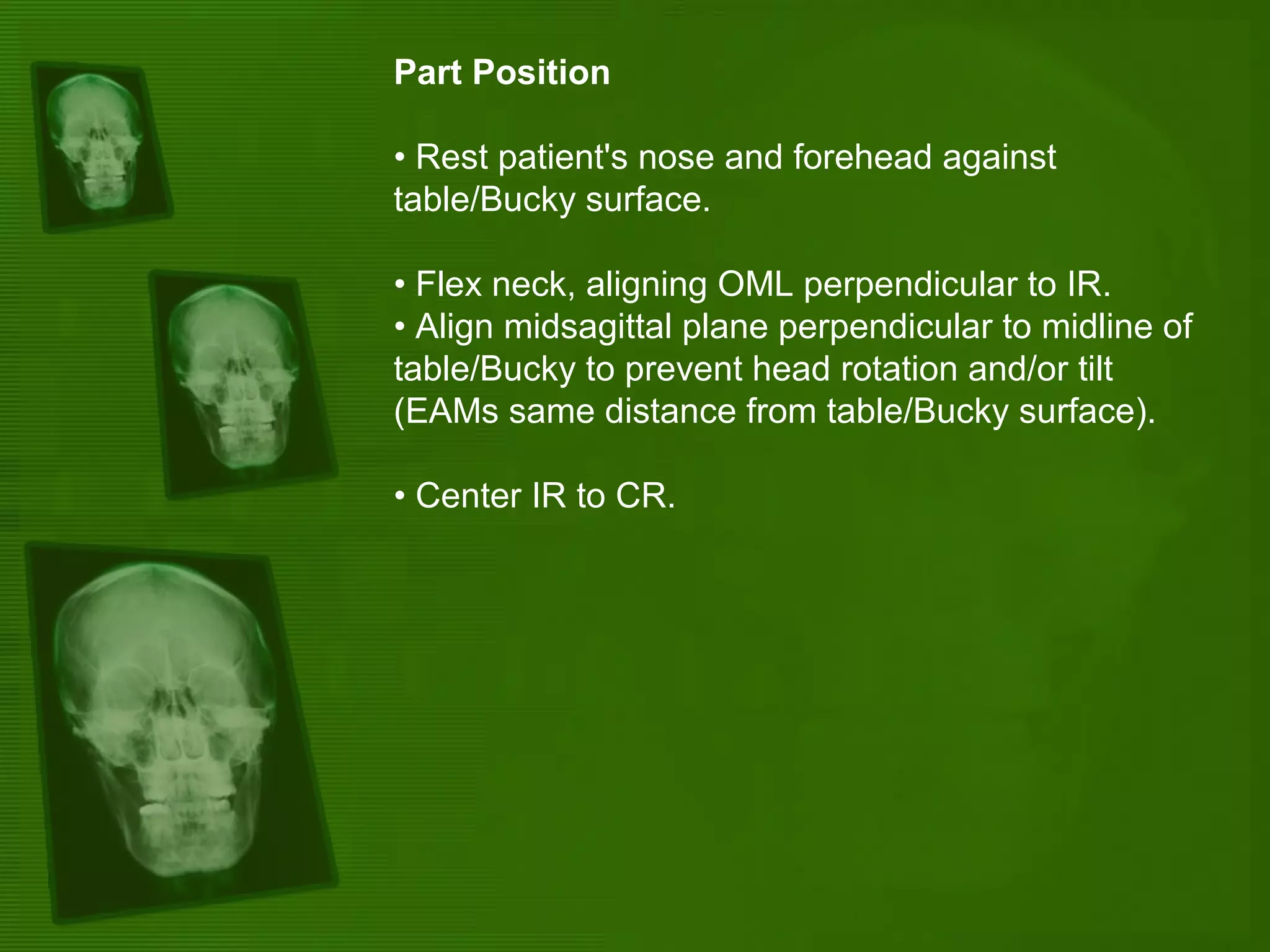 Positioning and radiographic anatomy of the skull | PPT