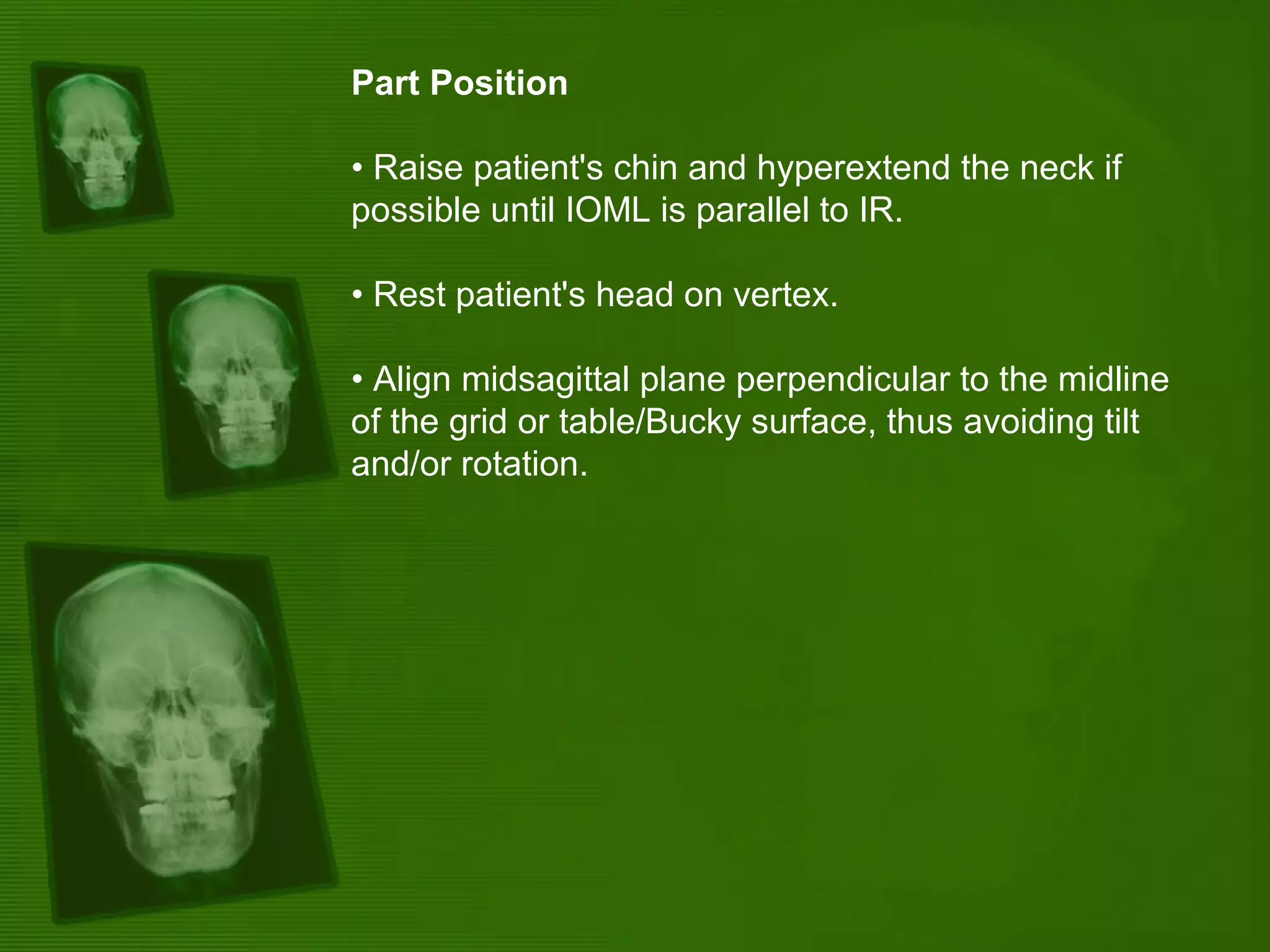 Positioning and radiographic anatomy of the skull | PPT