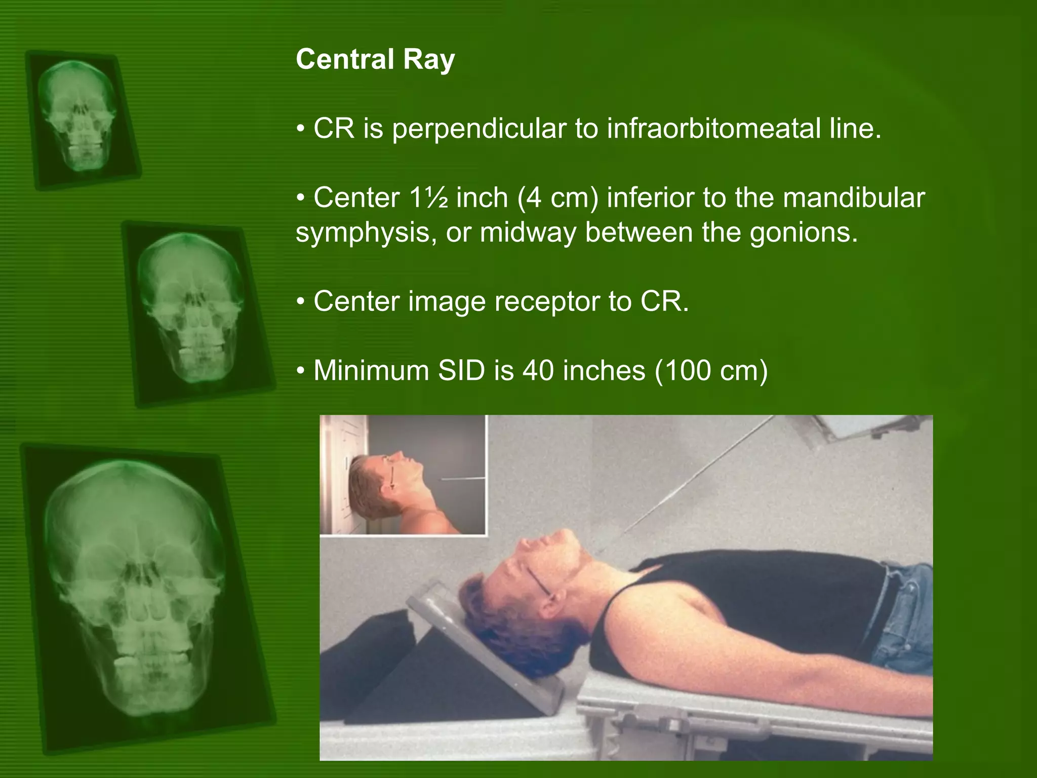 Positioning and radiographic anatomy of the skull | PPT