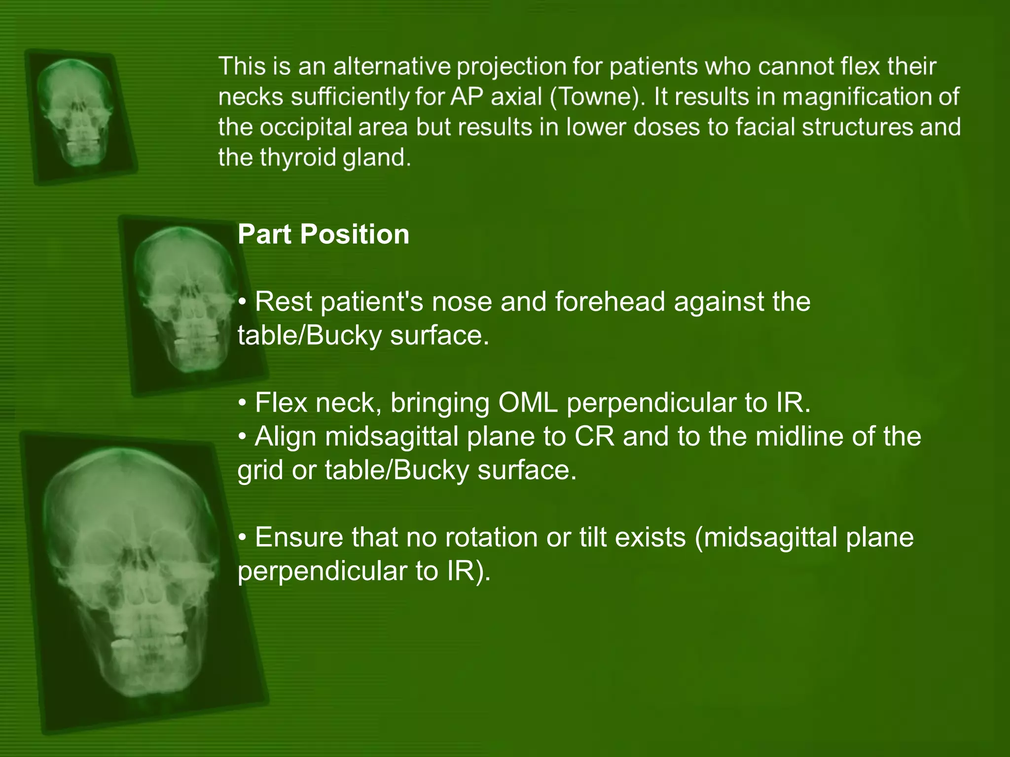 Positioning and radiographic anatomy of the skull | PPT