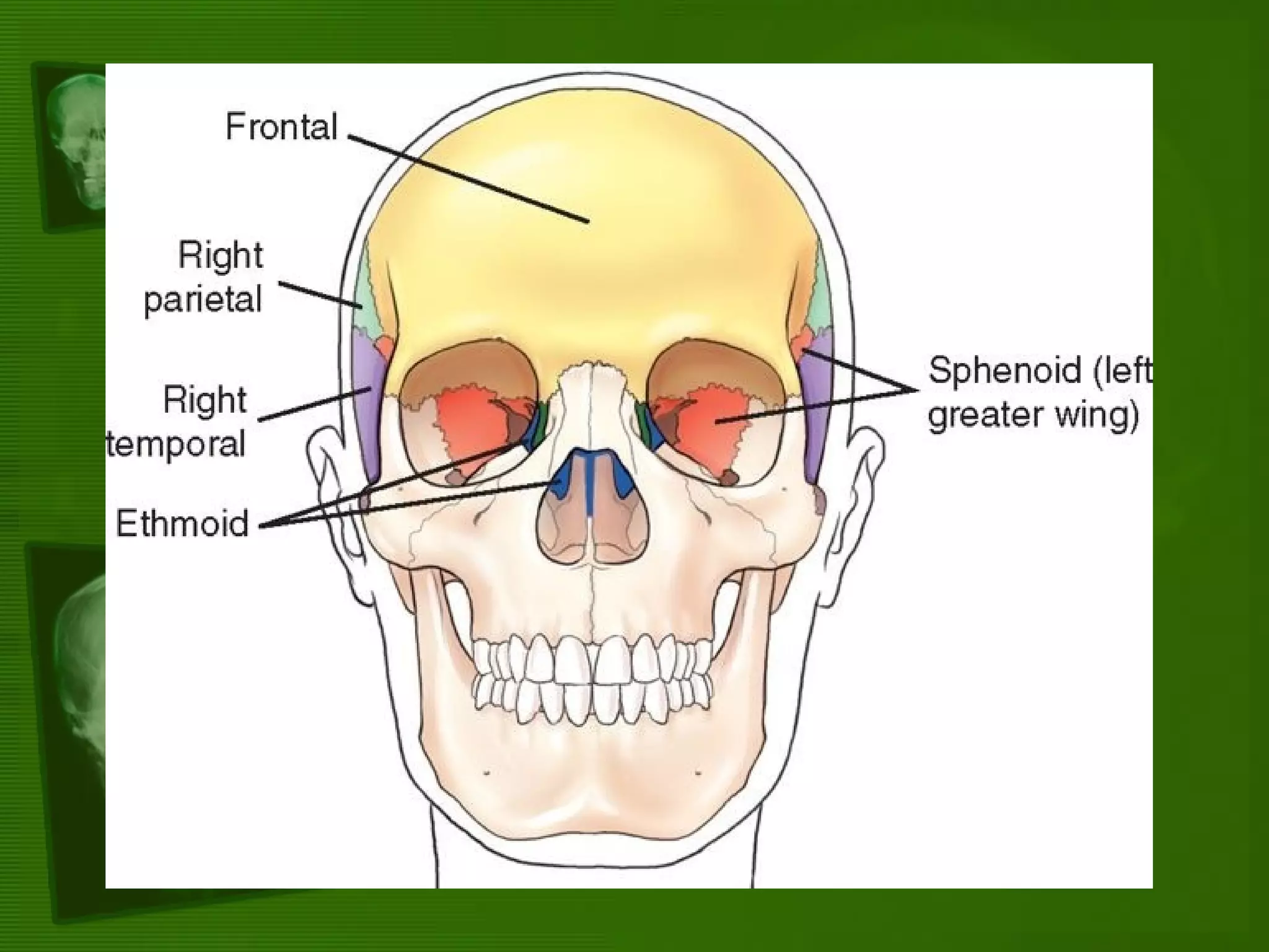 Positioning and radiographic anatomy of the skull | PPT