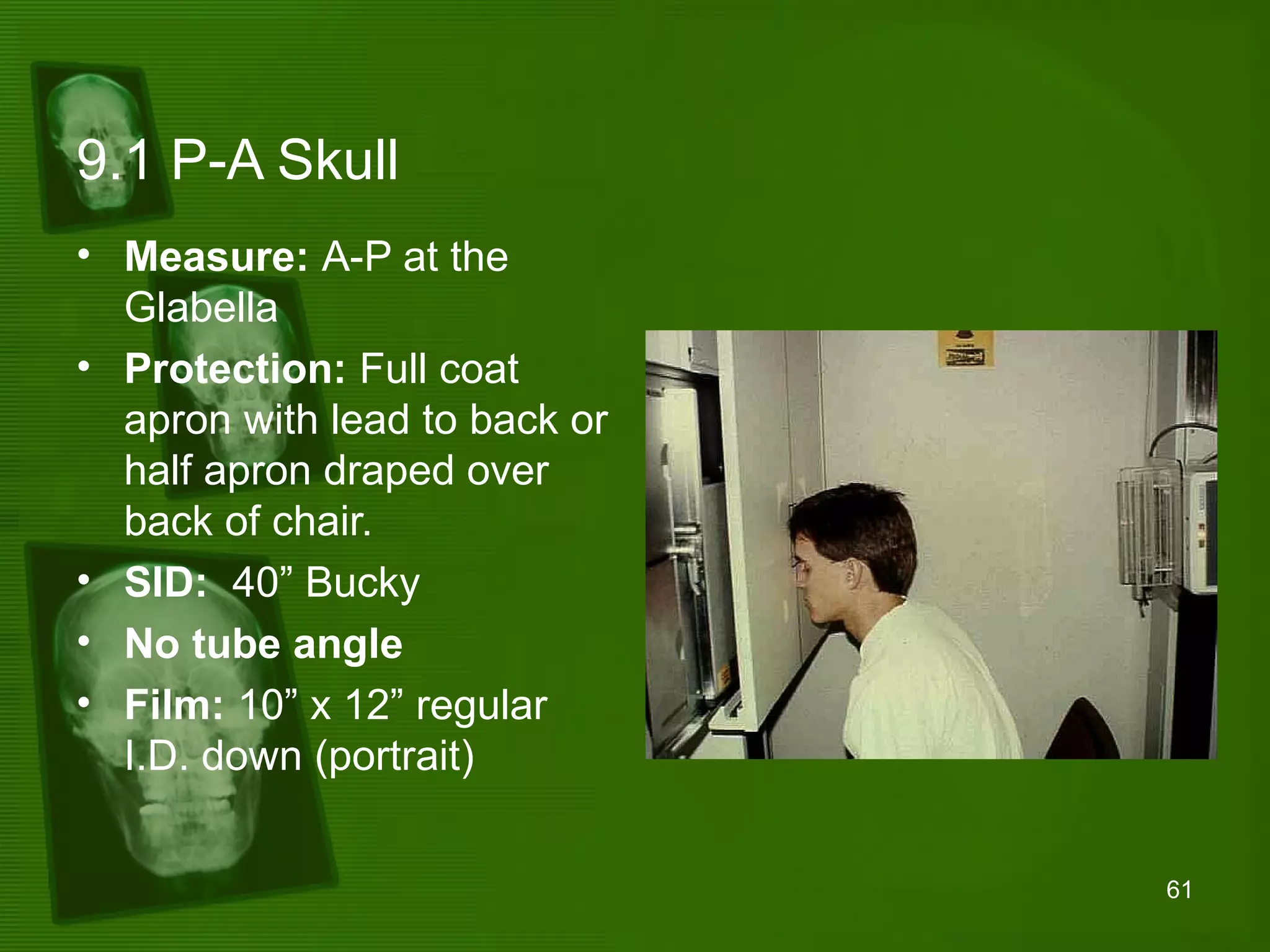 Positioning and radiographic anatomy of the skull | PPT