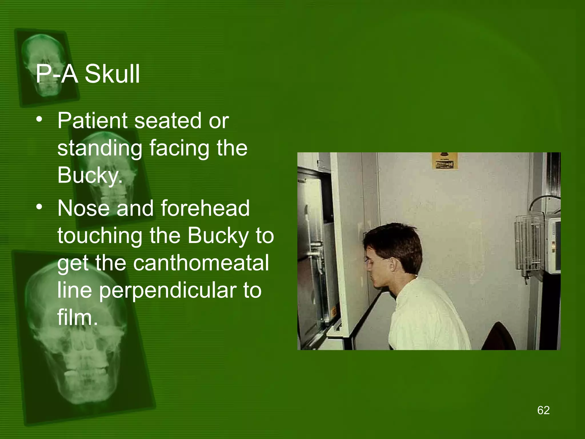 Positioning and radiographic anatomy of the skull | PPT