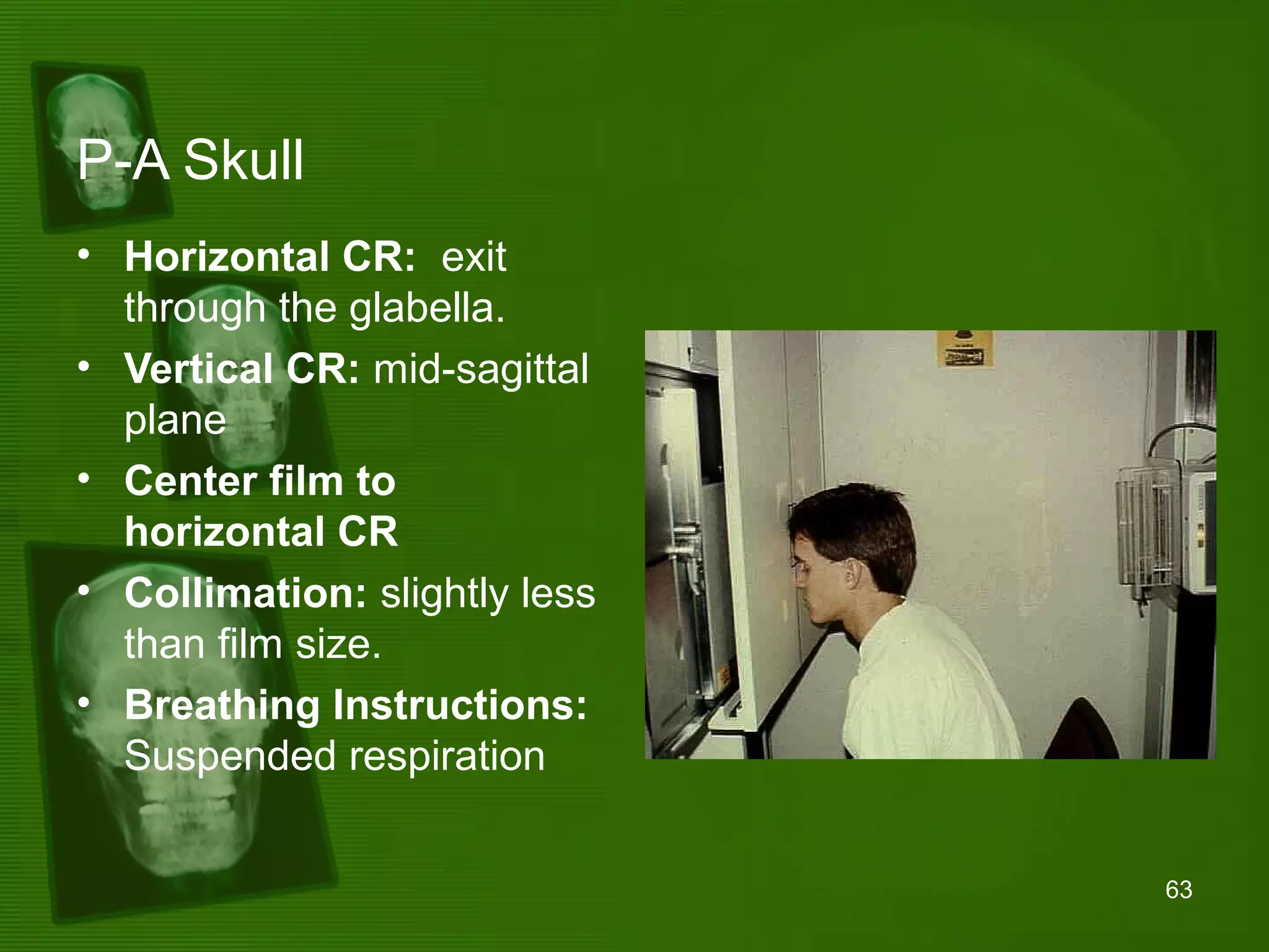 Positioning and radiographic anatomy of the skull | PPT