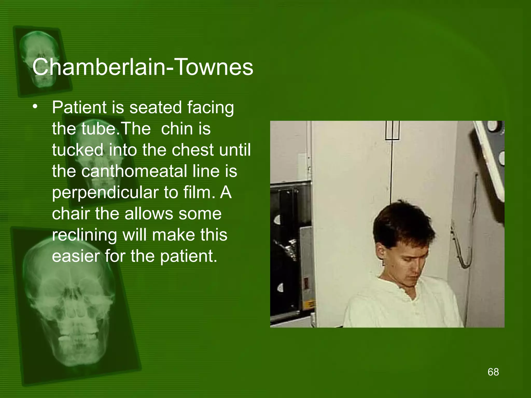 Positioning and radiographic anatomy of the skull | PPT